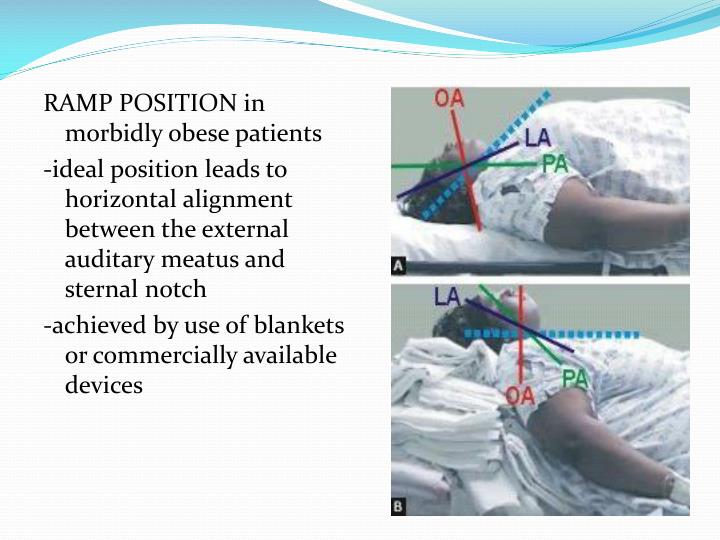 PPT - ANAESTHESIA FOR CAESAREAN SECTION ROLE OF INTRAUTERINE ...