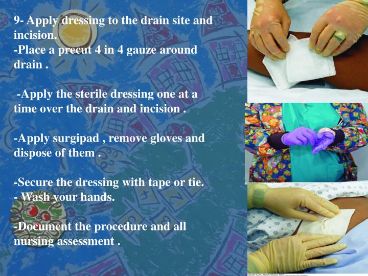 PPT - Wound dressing PowerPoint Presentation - ID:2988967
