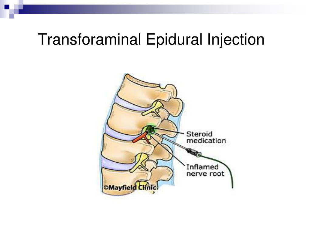 PPT - The Role of Physiatry in Occupational Medicine January 31, 2013 ...