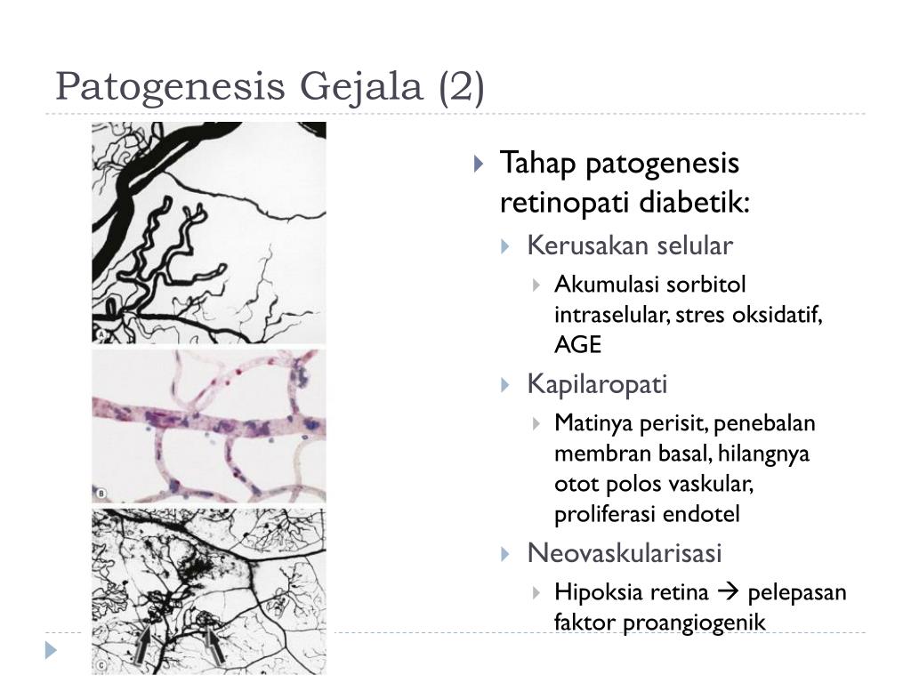 PPT - Diskusi Topik Mata Tenang dan Visus Turun Mendadak PowerPoint ...