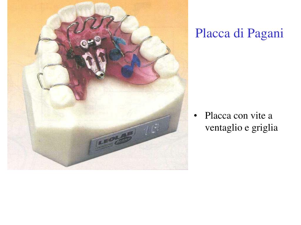PPT - Orthodontia mobile PowerPoint Presentation, free download - ID ...