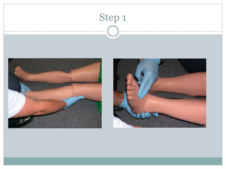 PPT - Sager Traction Splint PowerPoint Presentation - ID:2998062