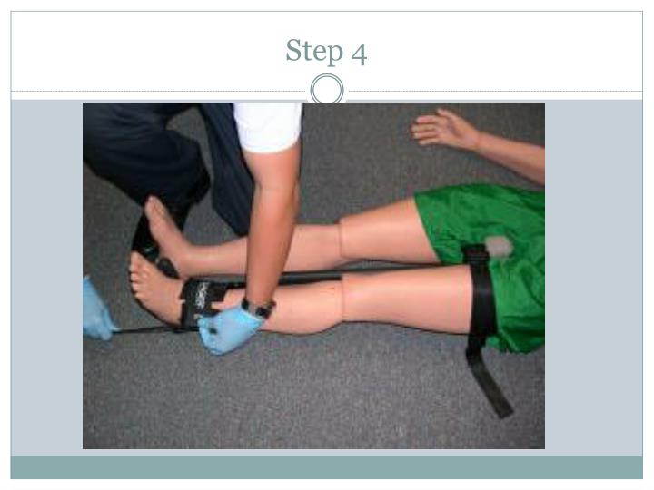 PPT - Sager Traction Splint PowerPoint Presentation - ID:2998062