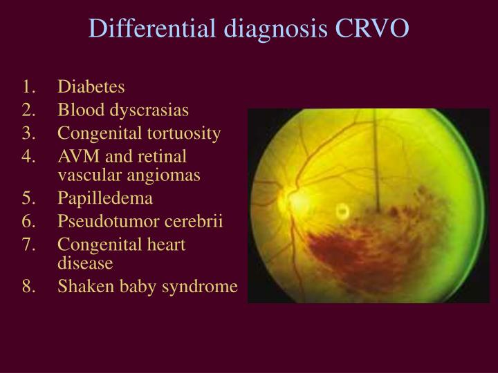 PPT - Acute Vision Loss PowerPoint Presentation - ID:3000924
