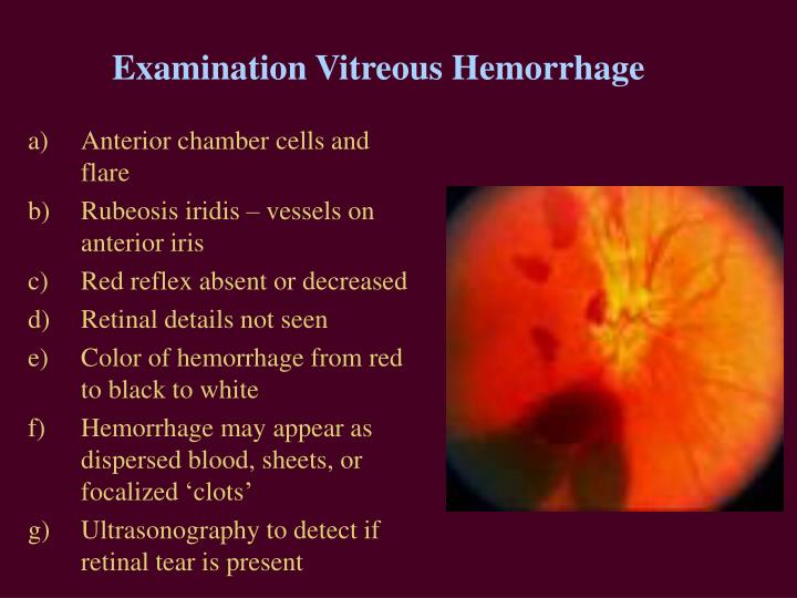 PPT - Acute Vision Loss PowerPoint Presentation - ID:3000924
