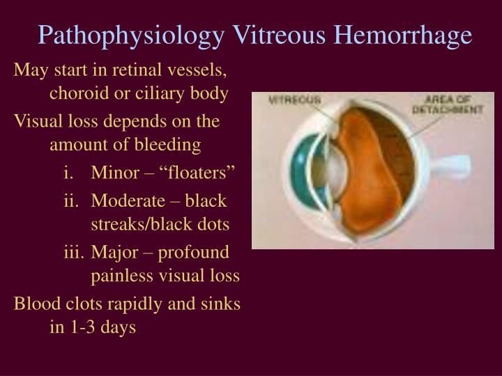 PPT - Acute Vision Loss PowerPoint Presentation - ID:3000924