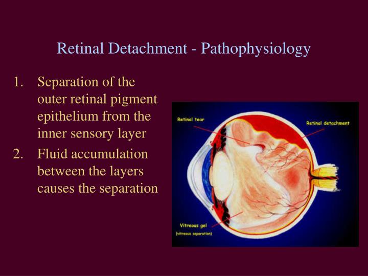 PPT - Acute Vision Loss PowerPoint Presentation - ID:3000924