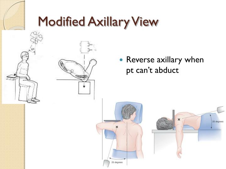 PPT - Radiography of the Shoulder PowerPoint Presentation - ID:3000947