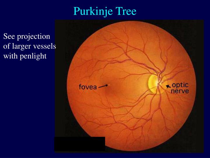 PPT - Entoptic Phenomena of Retinal Origin PowerPoint Presentation - ID ...