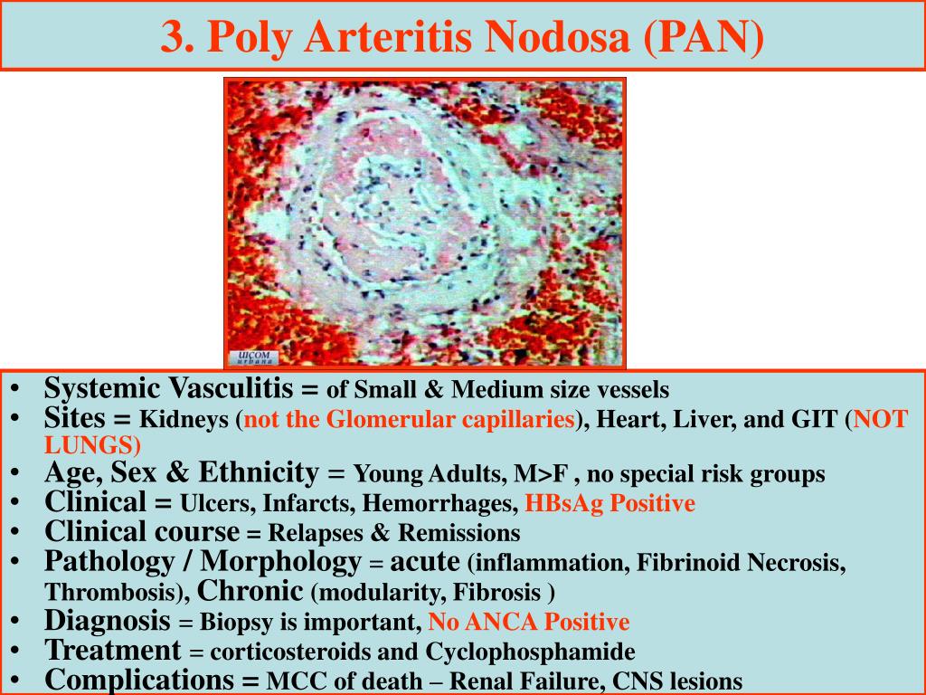 PPT - Blood Vessels PowerPoint Presentation, free download - ID:3001807