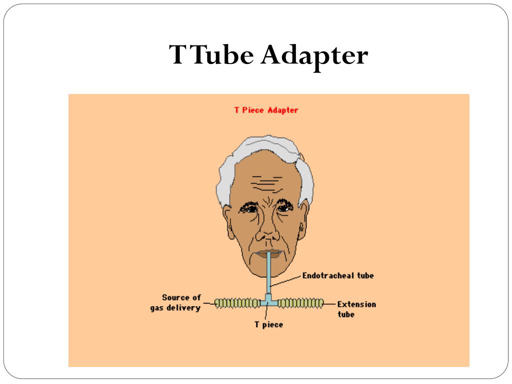 PPT - Ventilatory Care of Critically ill Patient and Weaning from ...