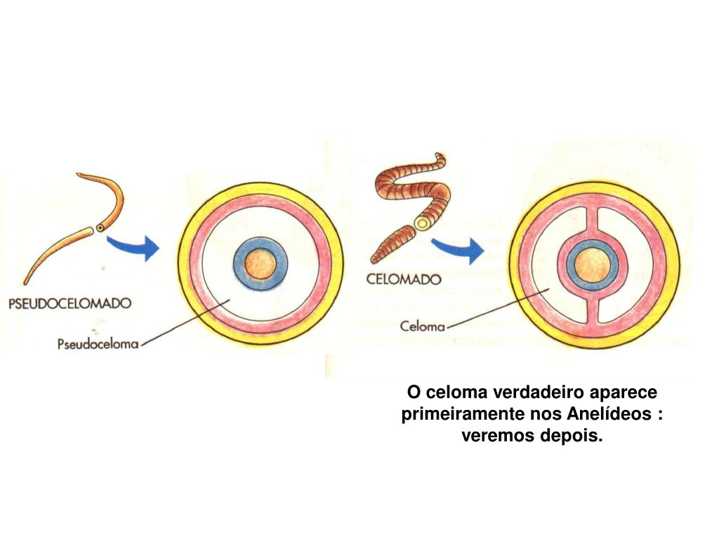 PPT - Filo Nematelmintos Características: Do grego, nemato = fio ou ...