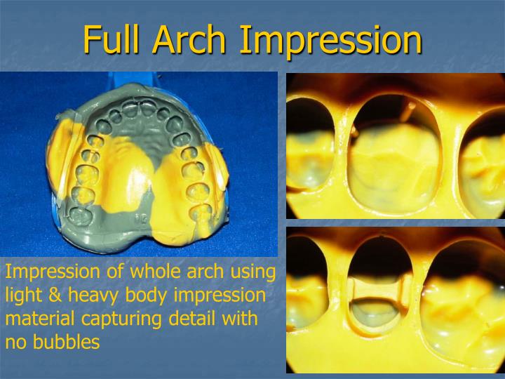 PPT - Introduction to Fixed Prosthodontics PowerPoint Presentation - ID ...