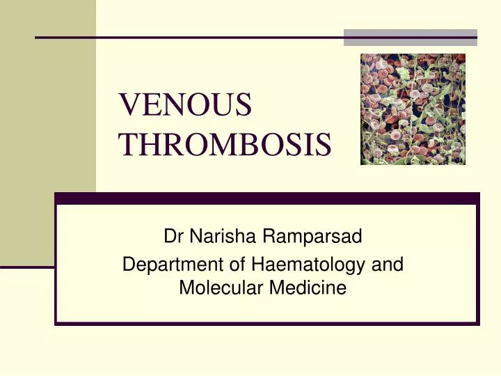 PPT - VENOUS THROMBOSIS PowerPoint Presentation, free download - ID:3003330