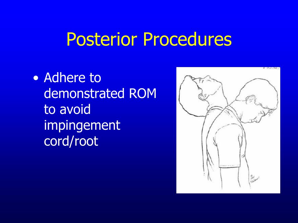 PPT - Nursing Care of the Postoperative Spine Patient Care PowerPoint ...
