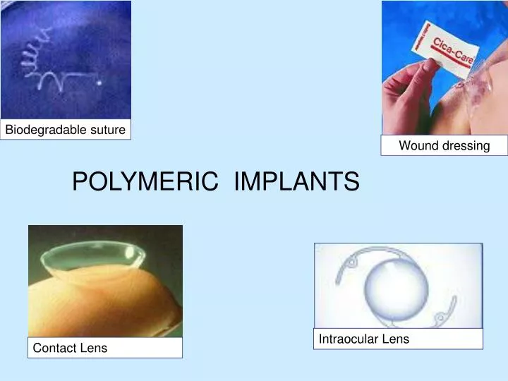 PPT - POLYMERIC IMPLANTS PowerPoint Presentation, free download - ID ...
