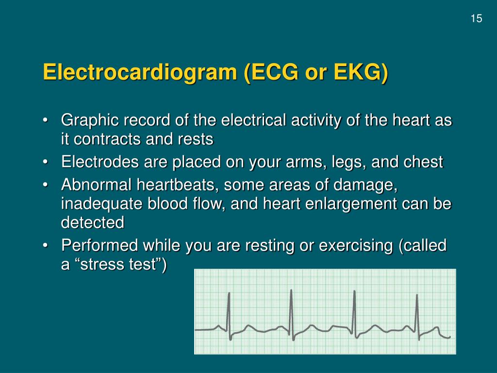 PPT - Women and Coronary Artery Disease (CAD) PowerPoint Presentation ...
