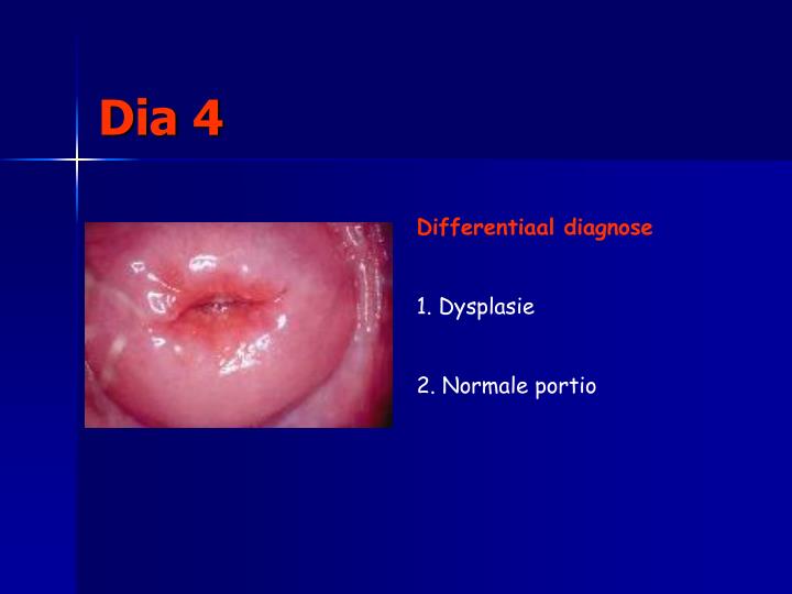 PPT - In Speculo PowerPoint Presentation - ID:3007387