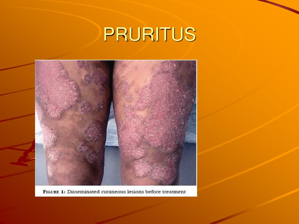 Ppt Dermatology Powerpoint Presentation Free Download Id 3007919
