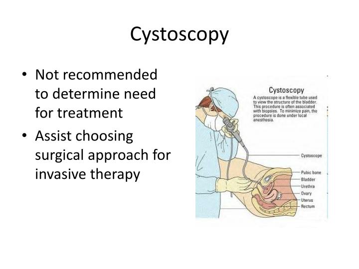 PPT - BPH PowerPoint Presentation - ID:3008348