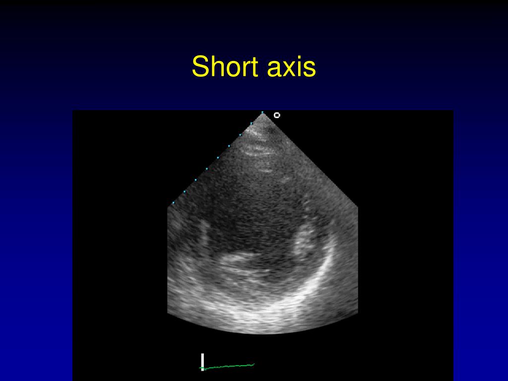 PPT - Echocardiography in the clinical situation: what can we do with ...