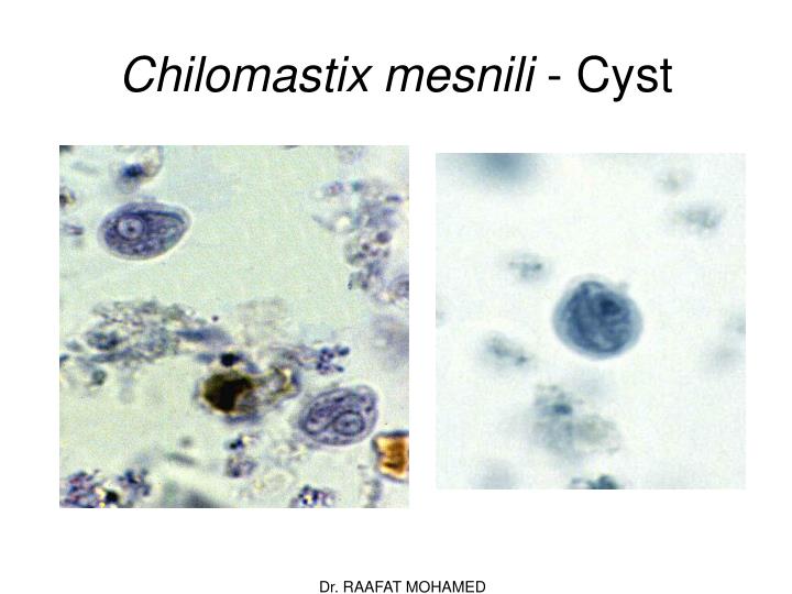 PPT - Trichomonas vaginalis PowerPoint Presentation - ID:3013018