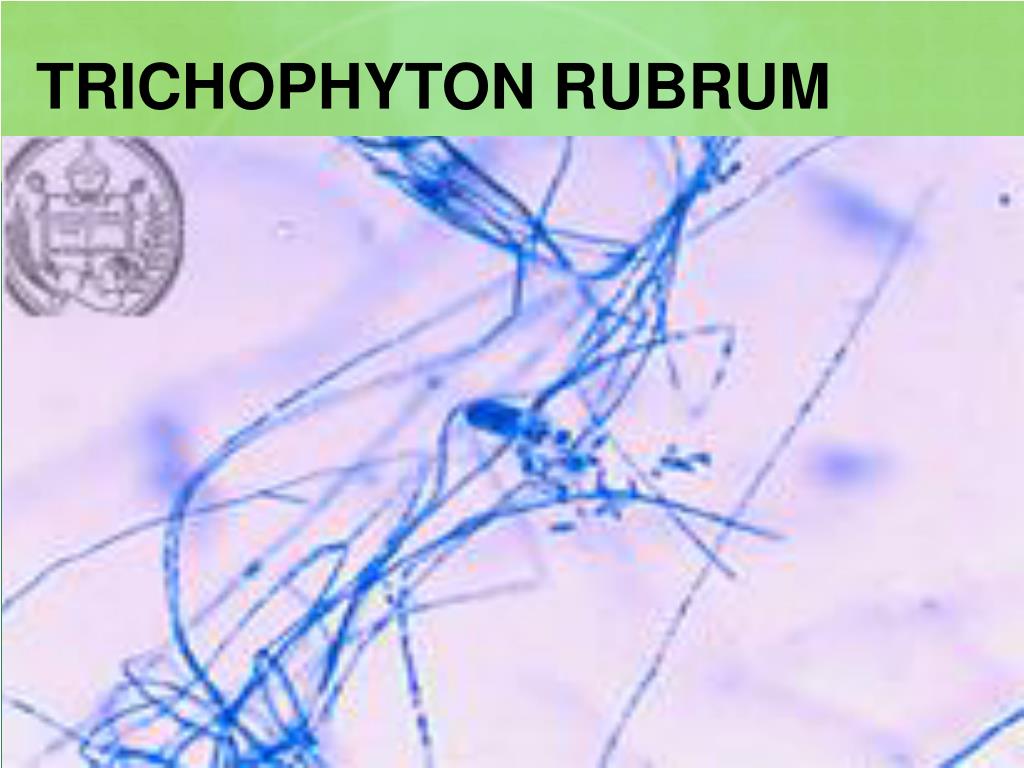 PPT - MICOSIS SUPERFICIALES Y CUTANEAS PowerPoint Presentation, free ...