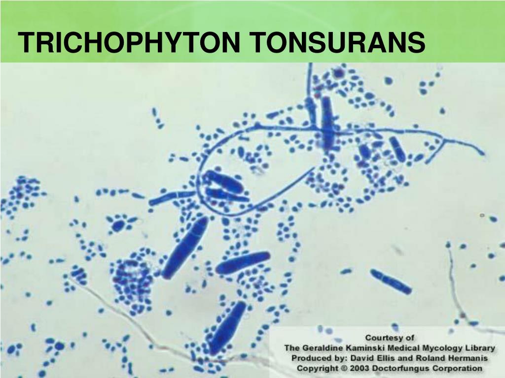 PPT - MICOSIS SUPERFICIALES Y CUTANEAS PowerPoint Presentation, free ...