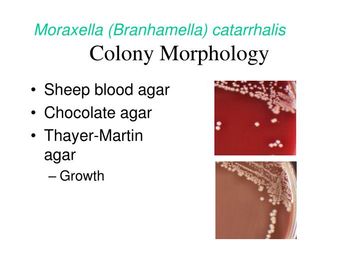 PPT - Aerobic Gram Negative Cocci PowerPoint Presentation - ID:3021698