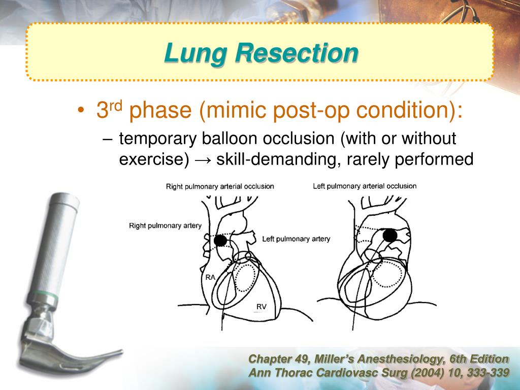 Ppt Preoperative Pulmonary Function Evaluation In Lung Resection