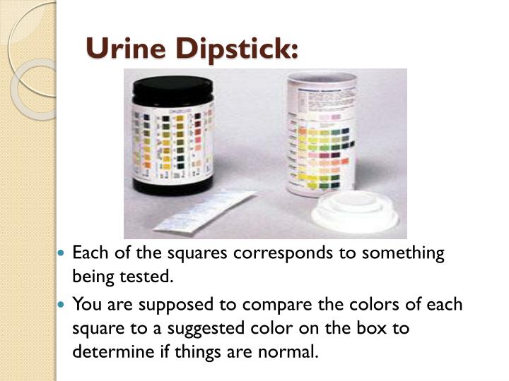 PPT - ACTIVITY 9 URINALYSIS PowerPoint Presentation - ID:3024131