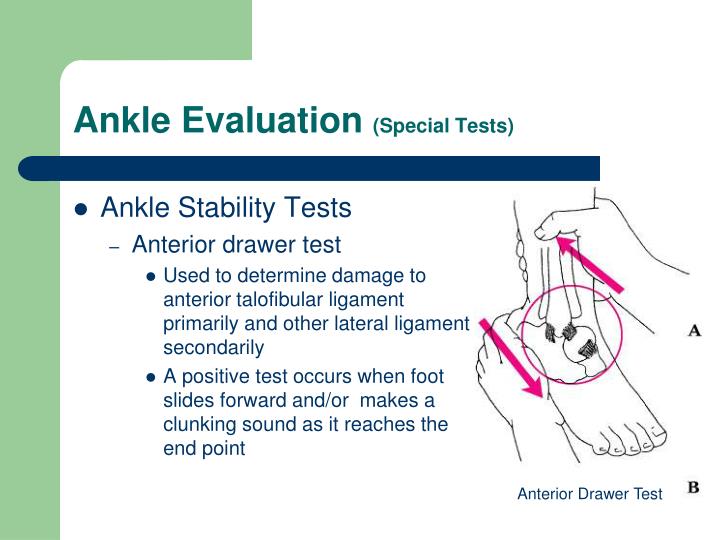 PPT - Foot and Ankle Seminar PowerPoint Presentation - ID:3024171