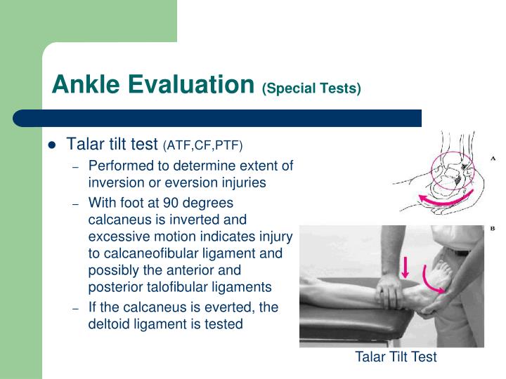 PPT - Foot and Ankle Seminar PowerPoint Presentation - ID:3024171