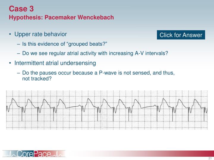 PPT - Pacemaker Troubleshooting Module 9 PowerPoint Presentation - ID ...