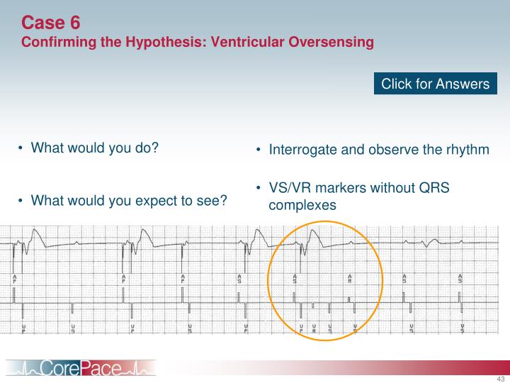 PPT - Pacemaker Troubleshooting Module 9 PowerPoint Presentation - ID ...