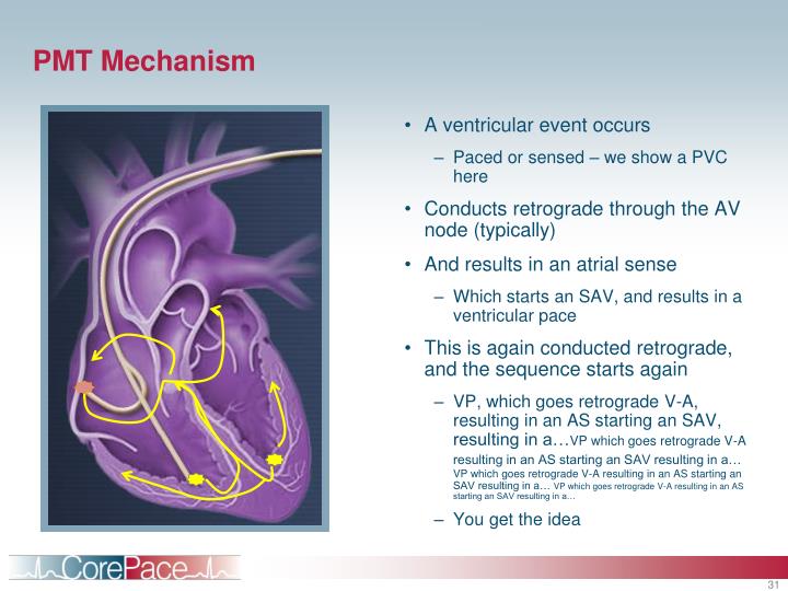 PPT - Pacemaker Troubleshooting Module 9 PowerPoint Presentation - ID ...