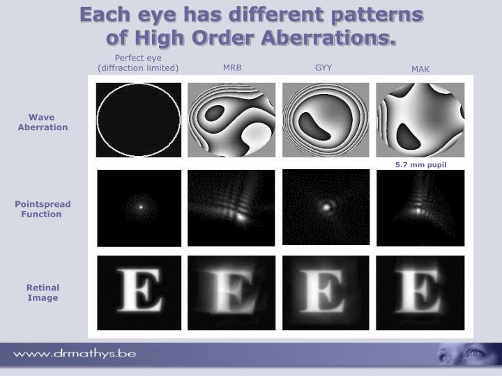 PPT - MYOPIA, ASTIGMATISM, HYPEROPIA… PowerPoint Presentation - ID:3028728