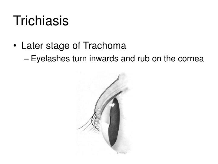 PPT - TRACHOMA PowerPoint Presentation - ID:3029397