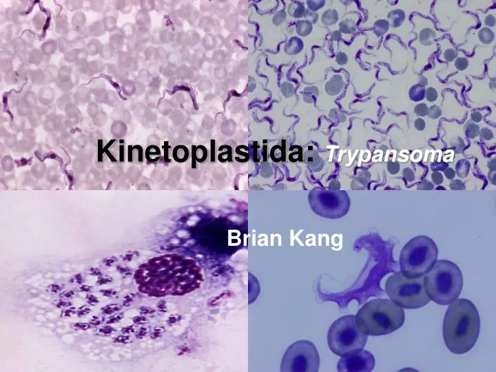 PPT - Kinetoplastida: Trypansoma PowerPoint Presentation, free download ...