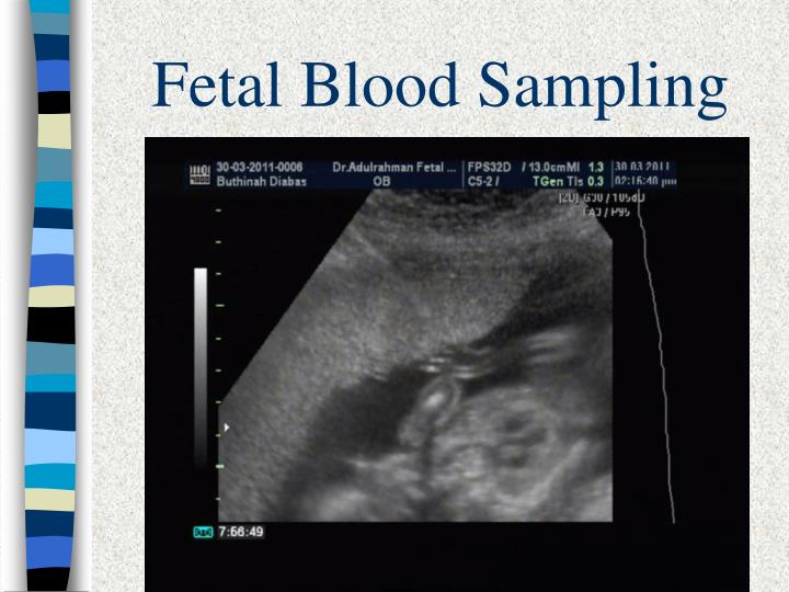 PPT - Rh Isoimmunization PowerPoint Presentation - ID:3030539