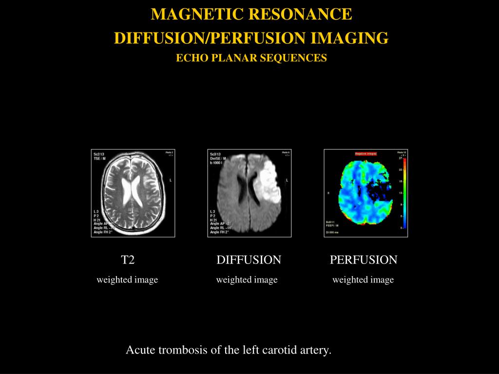 PPT - THE FRONTIERS OF MEDICAL IMAGING FERRUCCIO FAZIO PowerPoint ...