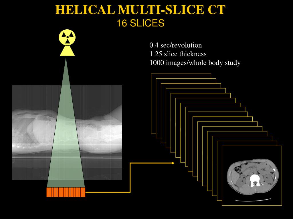 PPT - THE FRONTIERS OF MEDICAL IMAGING FERRUCCIO FAZIO PowerPoint ...