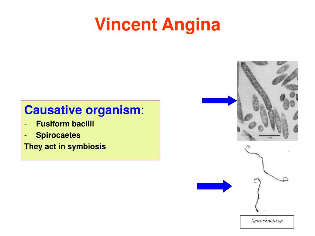 PPT - Acute Chronic Pharyngeal manifestations of systemic diseases ...
