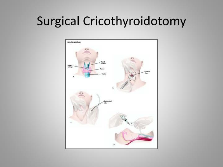 PPT - Surgical Airway Tintinalli Chap 20, 244 PowerPoint Presentation ...