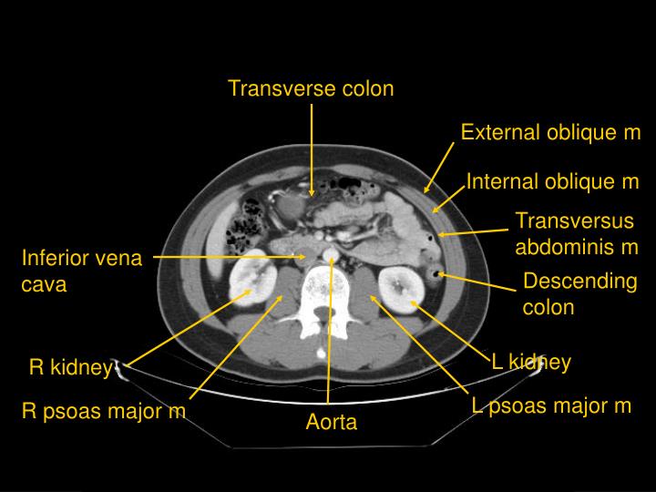 PPT - CT of Abdomen and Pelvis PowerPoint Presentation - ID:3031526