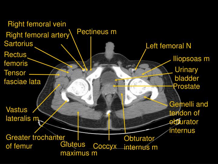 PPT - CT of Abdomen and Pelvis PowerPoint Presentation - ID:3031526