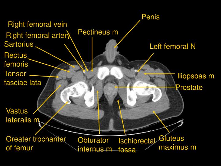 PPT - CT of Abdomen and Pelvis PowerPoint Presentation - ID:3031526