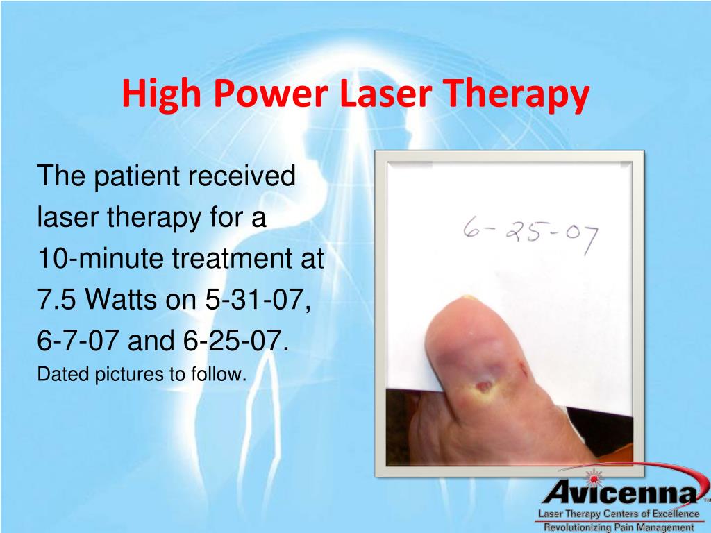 PPT - Wound Healing using the AVI HP- 7.5 Therapeutic Laser PowerPoint ...