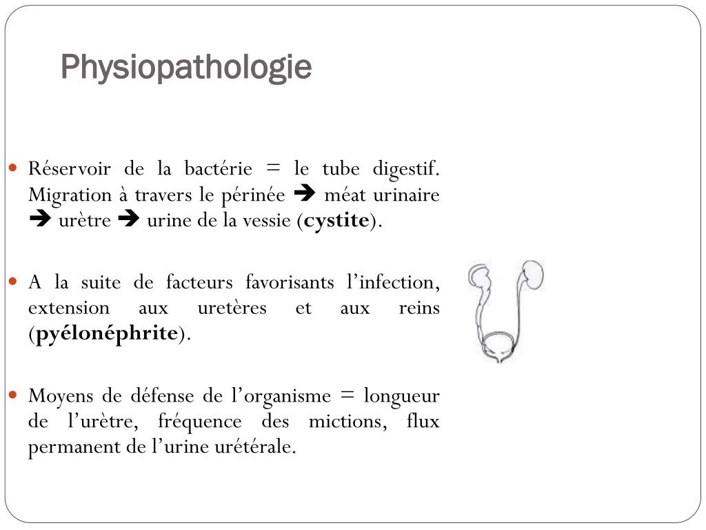 Ppt Les Infections Urinaires Powerpoint Presentation Free Download
