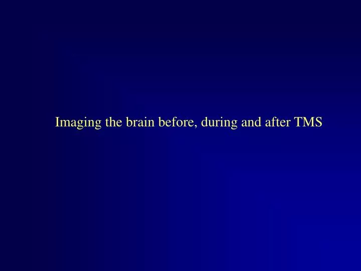 PPT - Imaging the brain before, during and after TMS PowerPoint ...